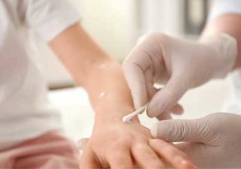 How to Treat Bed Bug Bites | Ja-Roy Pest Control